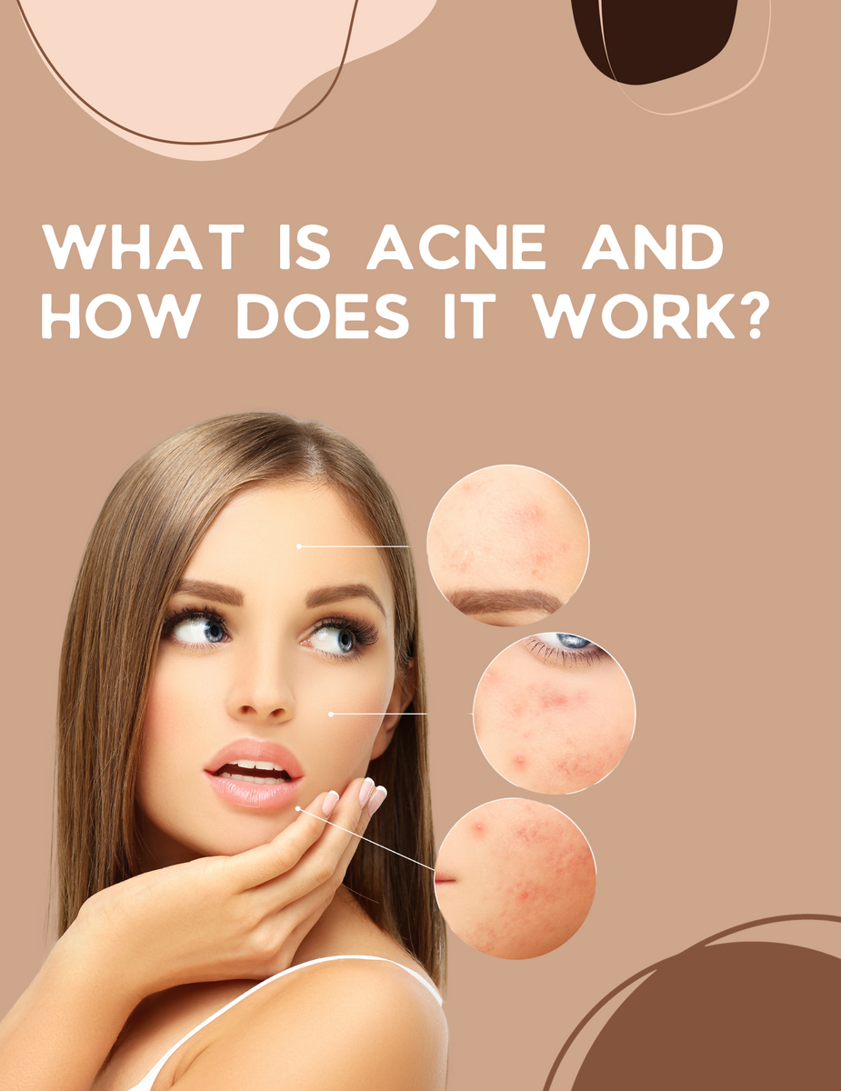 What is Acne and How Does it Work? – Ma'na Organix